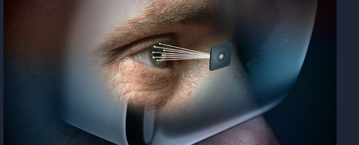 Prophesee, Tobii partner to develop event-based eye tracking solution