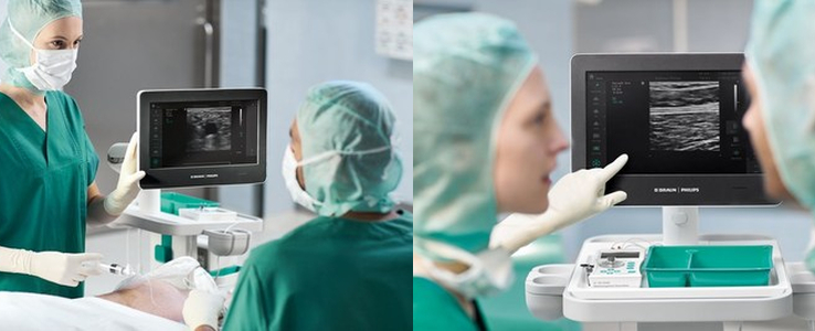 B. Braun and Philips join forces on ultrasound-guided regional anes...